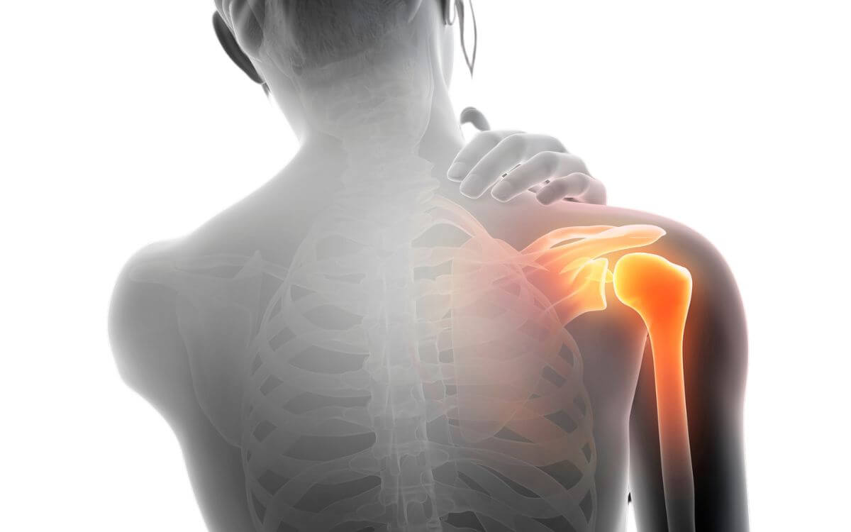 Myofascial pain syndrome.